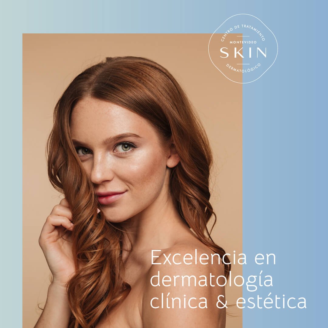 Montevideo Skin - Estudio Nómade